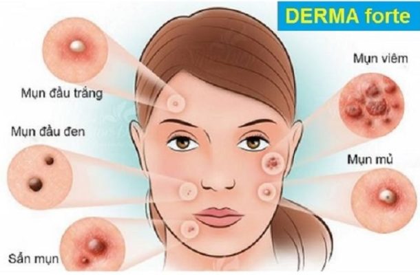 Review kem trị mụn Derma Forte có tốt không? - Đọc sách hay